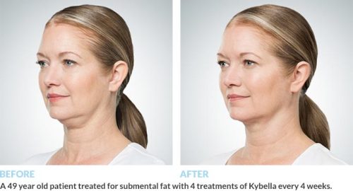 Cosmetic Dermatology - Shades Valley Dermatology